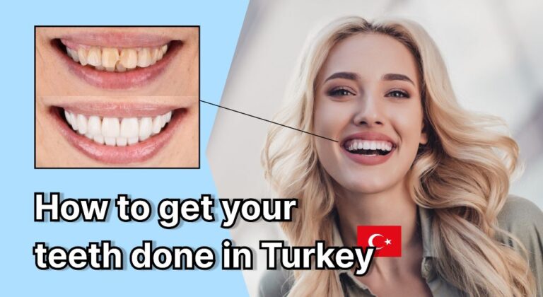 How to get your teeth done in Turkey – FindGlob