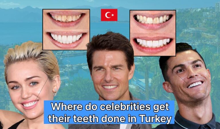 Where do celebrities get their teeth done in Turkey?